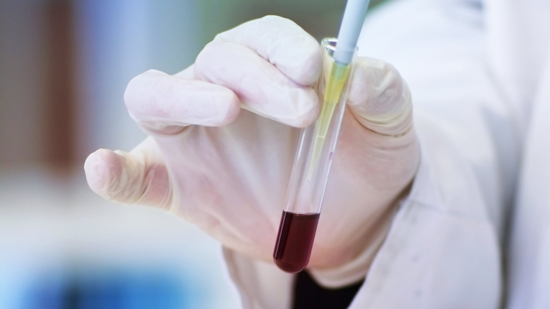 How Long Do Benzodiazepines Stay In Your System?
